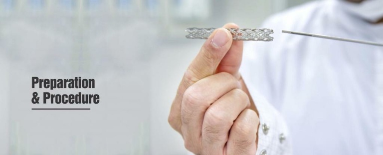 What you need to know about stents? - Healing Hospital